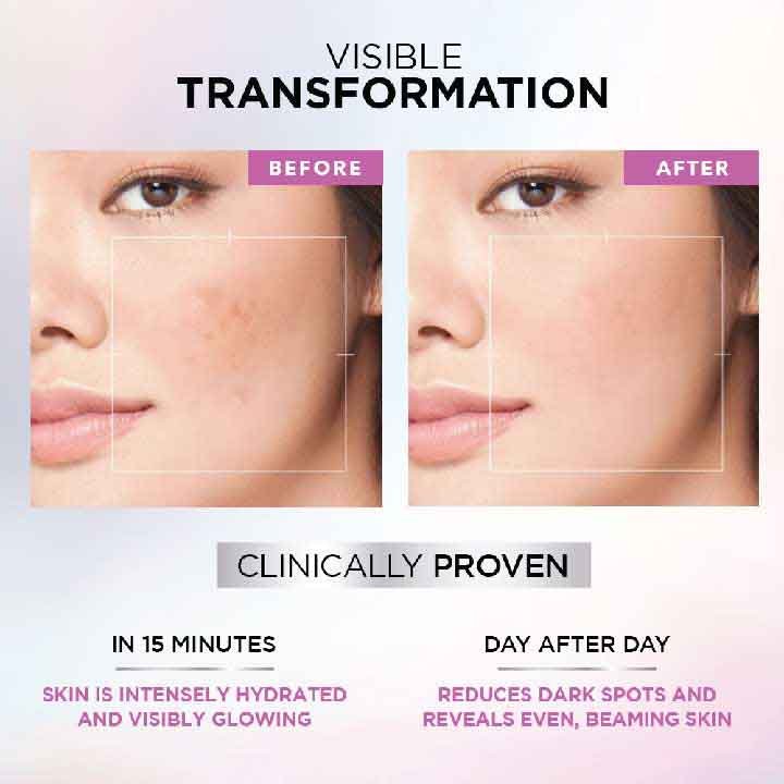 L'Oréal Paris Glycolic Bright Day Cream with SPF 17 , 15 ml