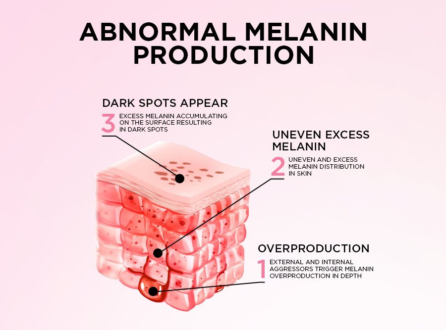 L'Oréal Paris - Melasyl For Glowing Skin | Dark Spot Treatment